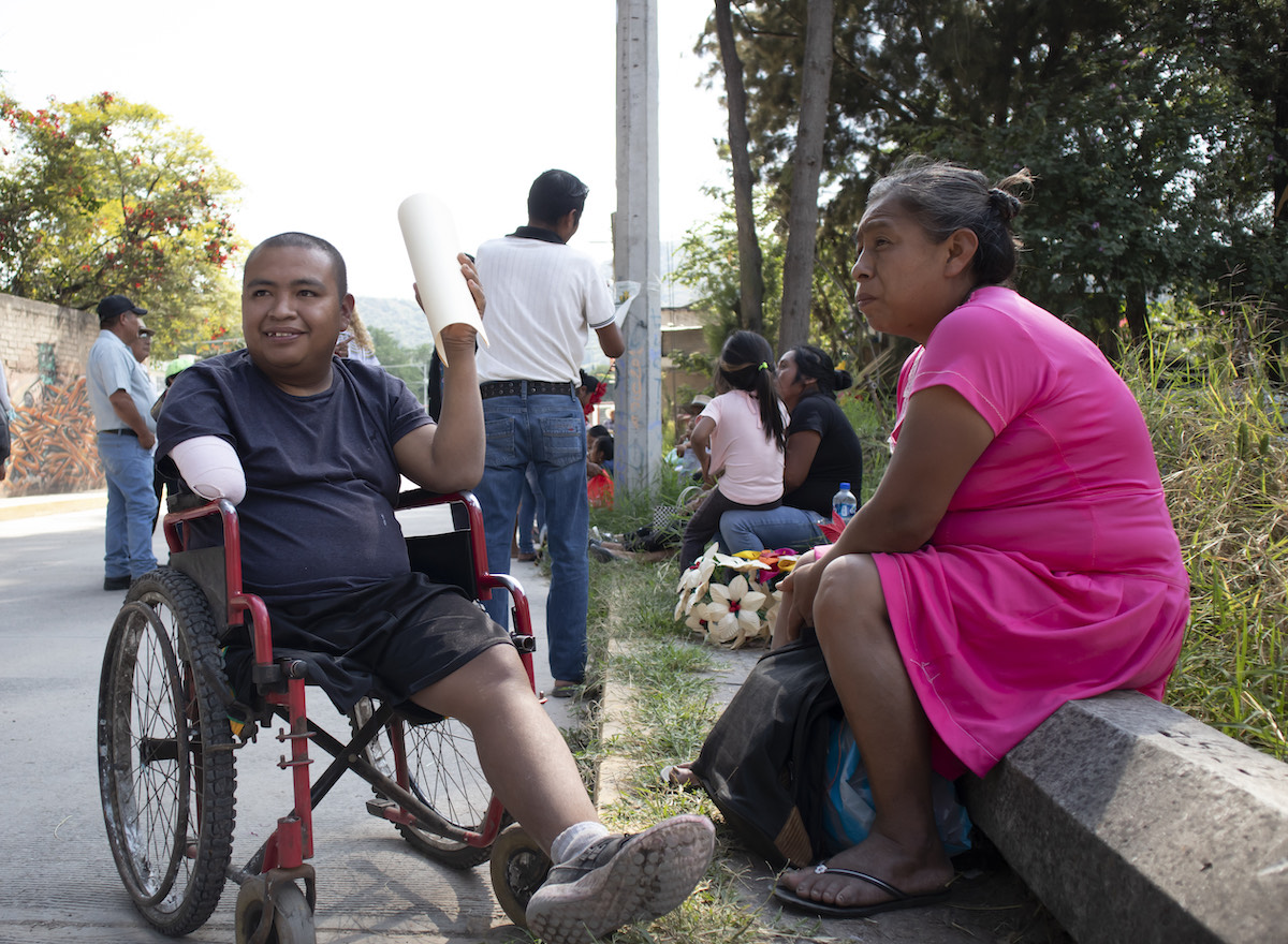 Gaudencio Arrollado Por La Bestia Pide Ayuda Para Sus Prótesis De Pierna Y Brazo En El Camino